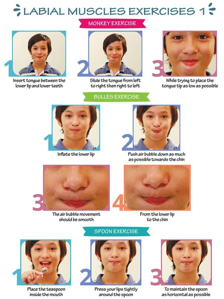 Early Orthodontic & Functional Treatment – Starlight Dental Clinic